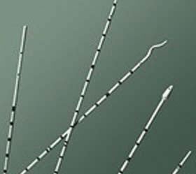 Bx/10 Ureteral Catheter,Polyurethane ,Cone Tip W/Adapter,7Fr X 70Cm